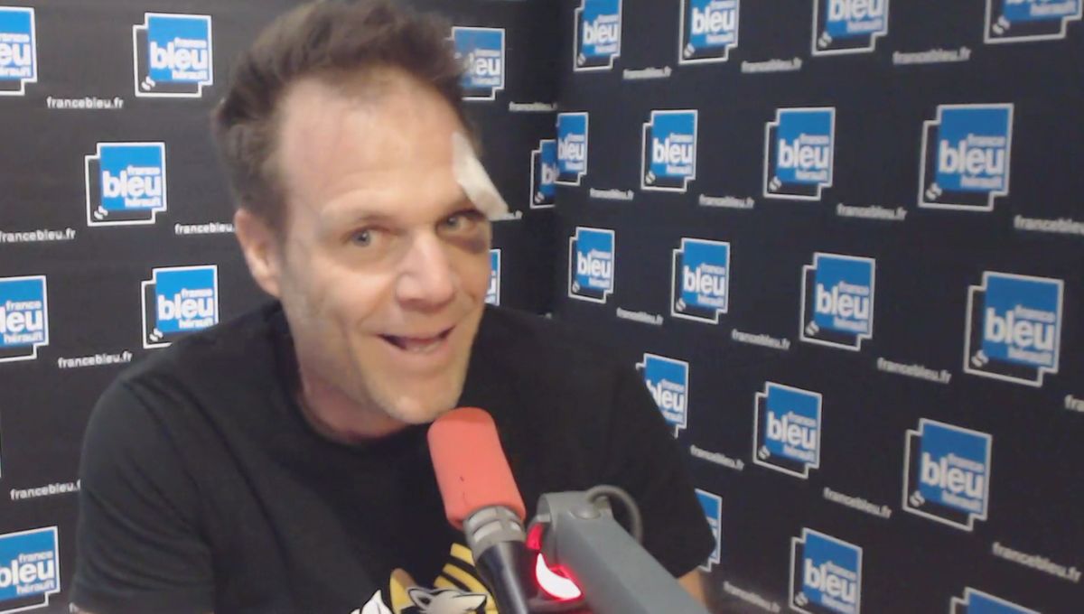 Rémi Gaillard, amoché et à la bourre